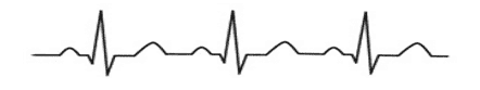 Zelf Hartfilmpje (ECG) Maken: De Beste Manieren & Producten